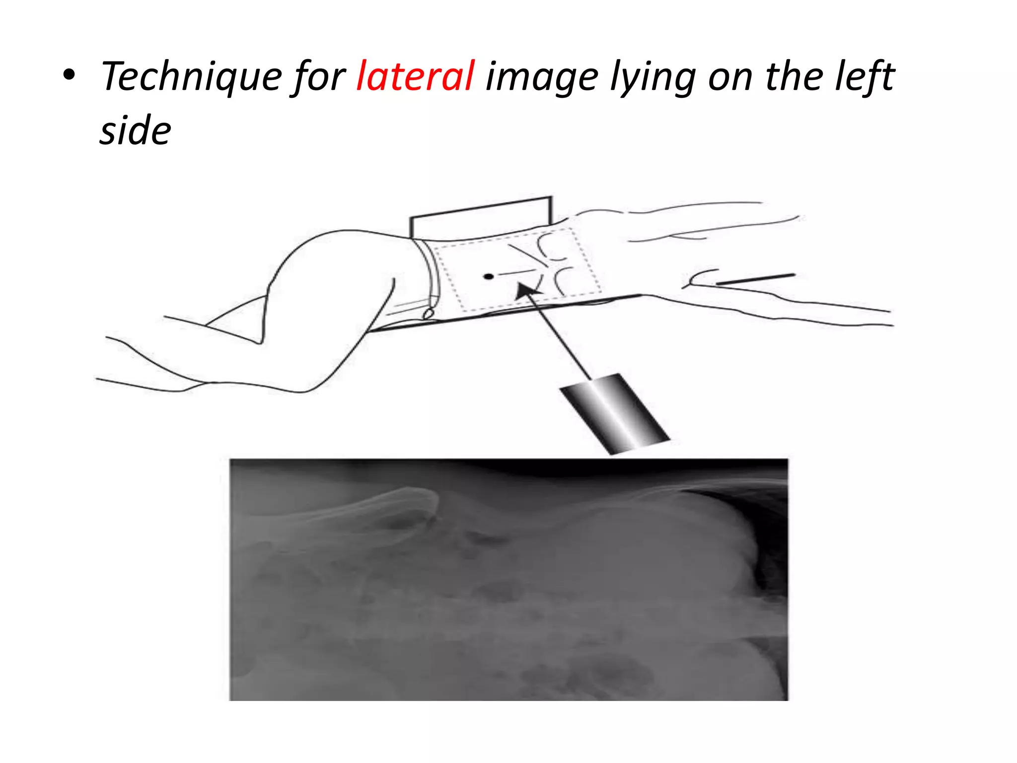 Abdominal x ray | PPTX