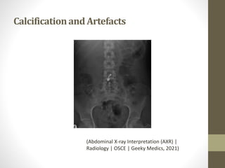 Abdominal x ray . axr | PPT