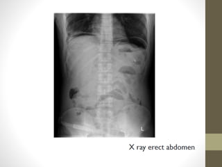 Abdominal x ray . axr | PPT