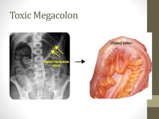 Abdominal x ray . axr | PPT