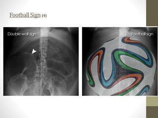 Abdominal x ray . axr | PPT