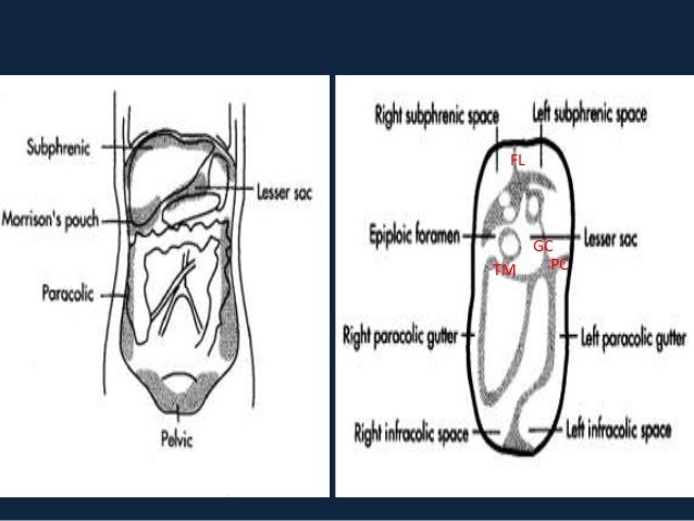 Introduction to Abdominal x ray