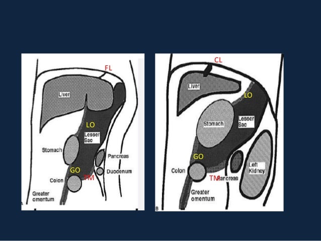 Introduction to Abdominal x ray