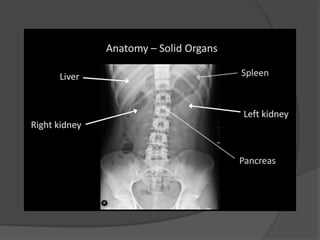 Abdominal X-RAYS- view , surgery point of view | PPTX