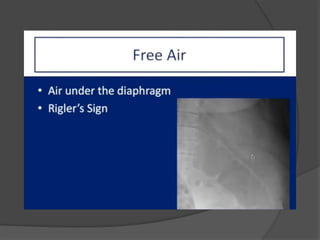 Abdominal X-RAYS- view , surgery point of view | PPTX