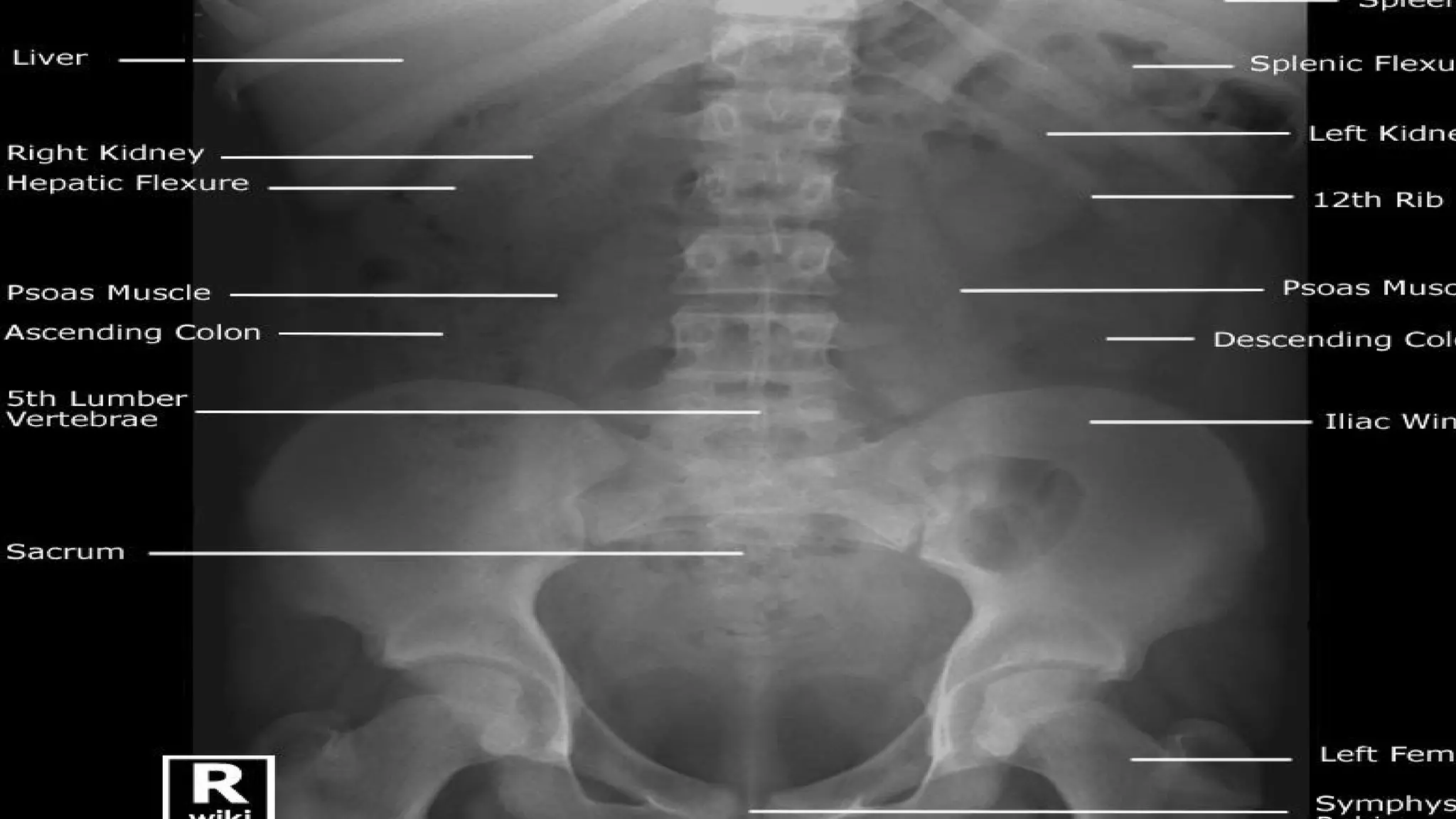 Abdominal X ray | PDF