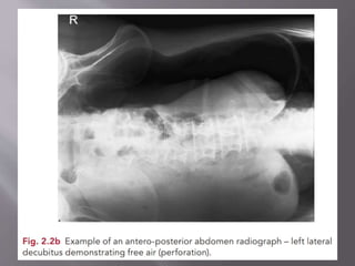 Abdominal x ray- views.pptx