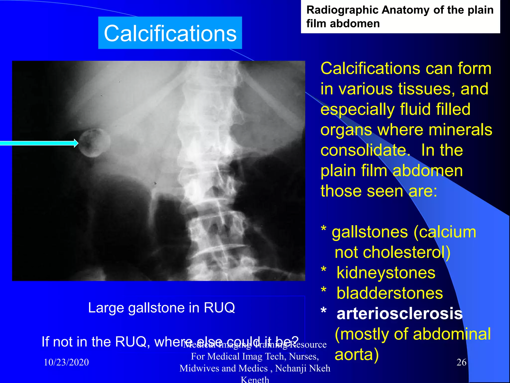Abdominal x ray axr radiology training resource nchanji nkeh keneth | PDF