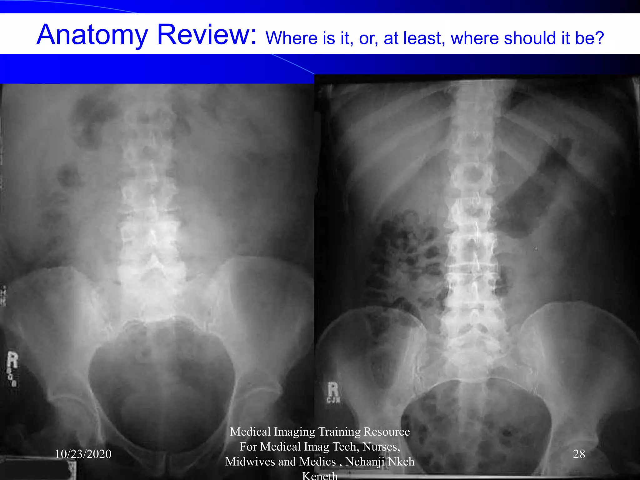 Abdominal x ray axr radiology training resource nchanji nkeh keneth | PDF