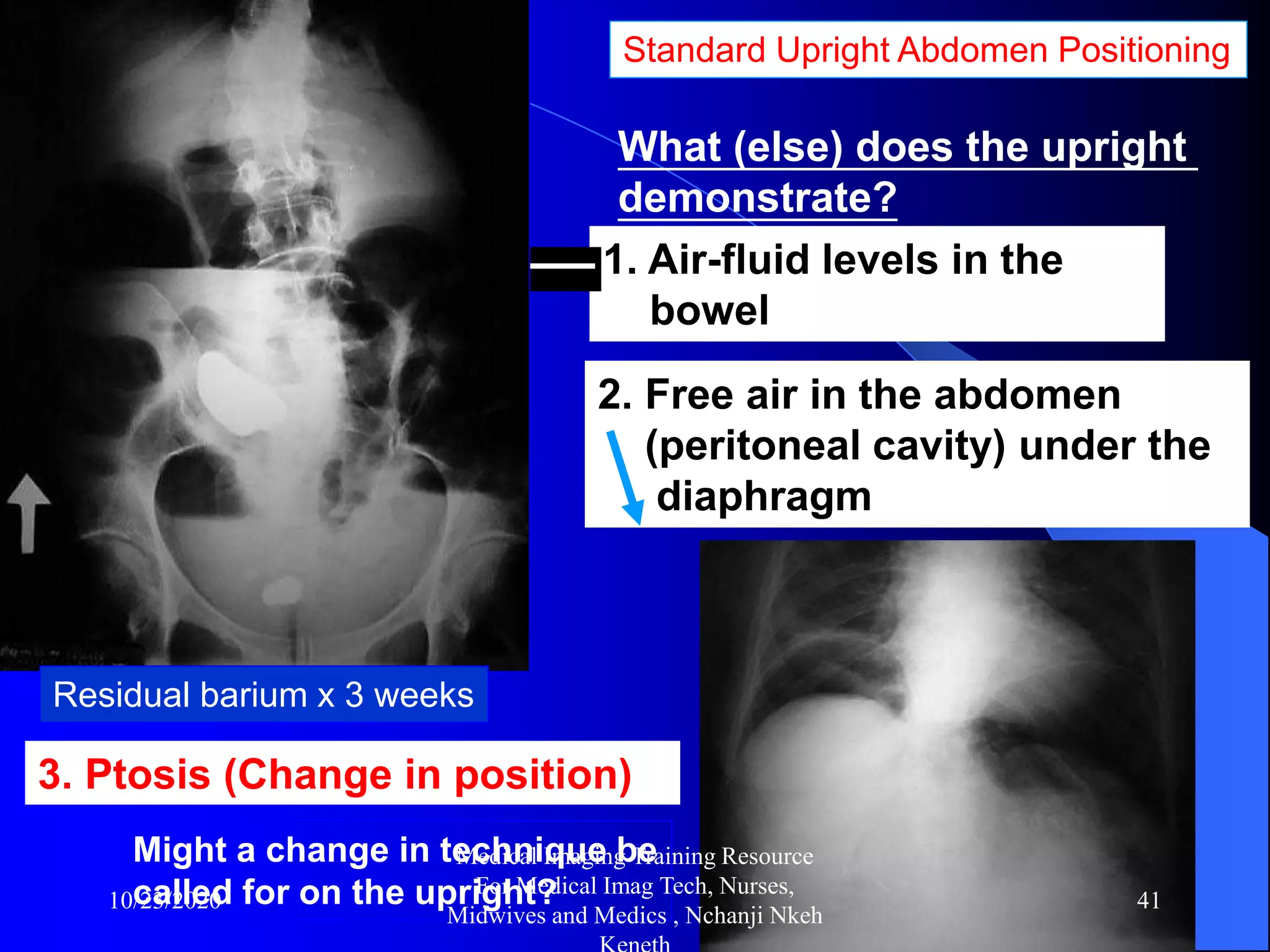 Abdominal x ray axr radiology training resource nchanji nkeh keneth | PDF