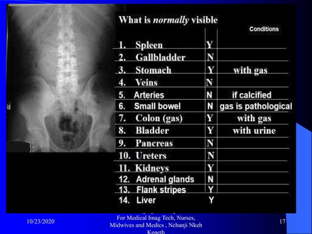 Abdominal x ray axr radiology training resource nchanji nkeh keneth | PDF