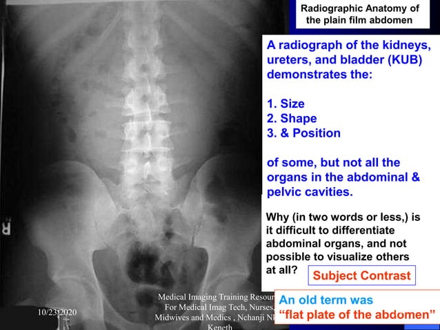 Abdominal x ray axr radiology training resource nchanji nkeh keneth | PDF