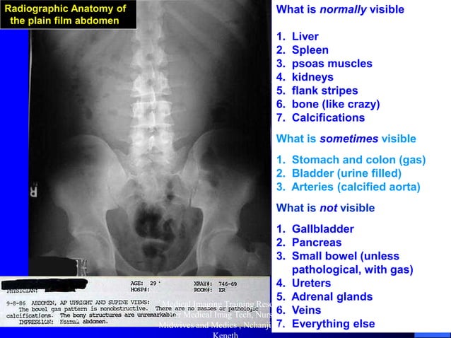 Abdominal x ray axr radiology training resource nchanji nkeh keneth | PDF