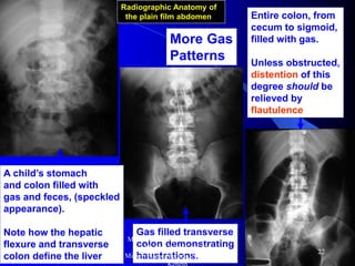 Abdominal x ray axr radiology training resource nchanji nkeh keneth | PDF