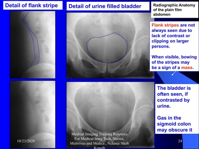 Abdominal x ray axr radiology training resource nchanji nkeh keneth | PDF