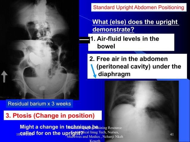 Abdominal x ray axr radiology training resource nchanji nkeh keneth | PDF