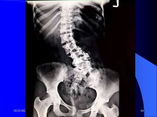 Abdominal x ray axr radiology training resource nchanji nkeh keneth | PDF