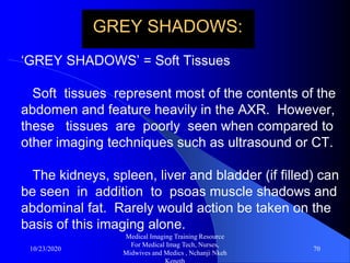 Abdominal x ray axr radiology training resource nchanji nkeh keneth | PDF