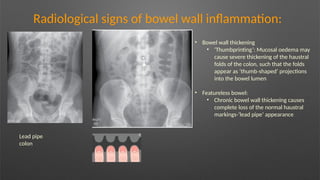 Abdominal xray RADIOLOGY final.pptx .pptx