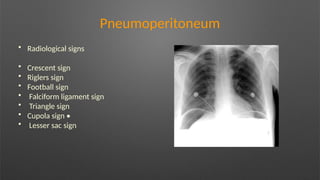 Abdominal xray RADIOLOGY final.pptx .pptx