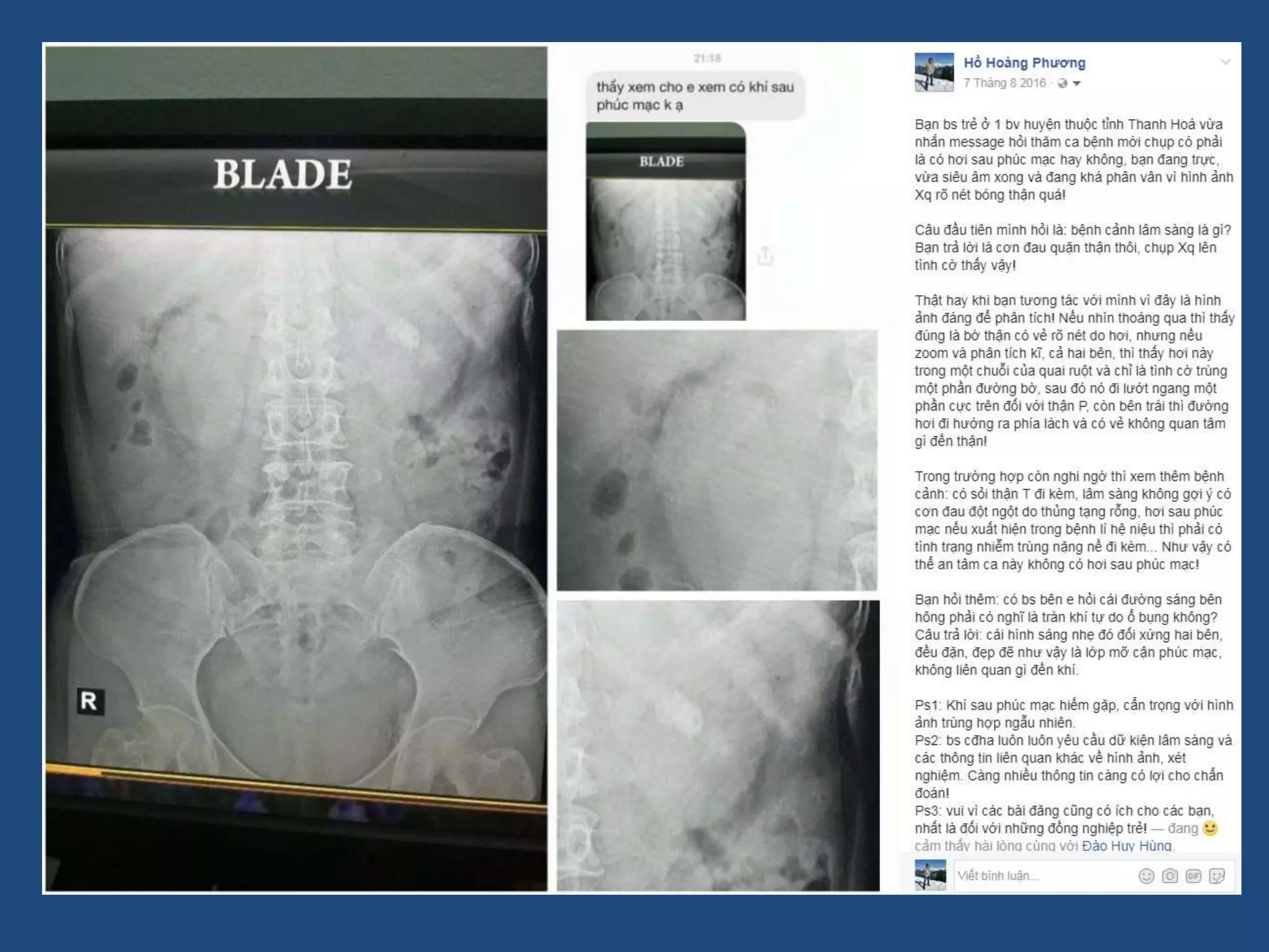 Abdominal x ray lop he 2018 | PPT