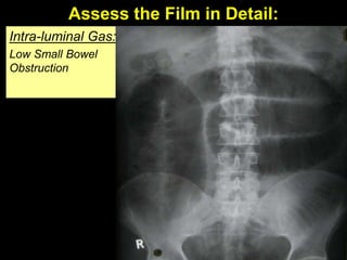 abdominal x ray presentation 2.ppt