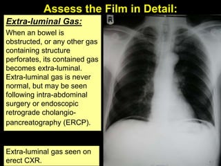 abdominal x ray presentation 2.ppt