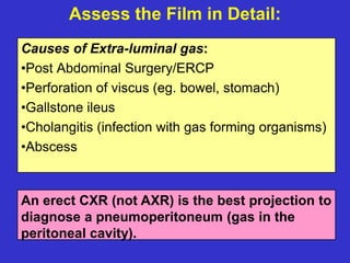 abdominal x ray presentation 2.ppt