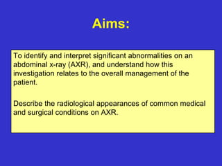 abdominal x ray presentation 2.ppt