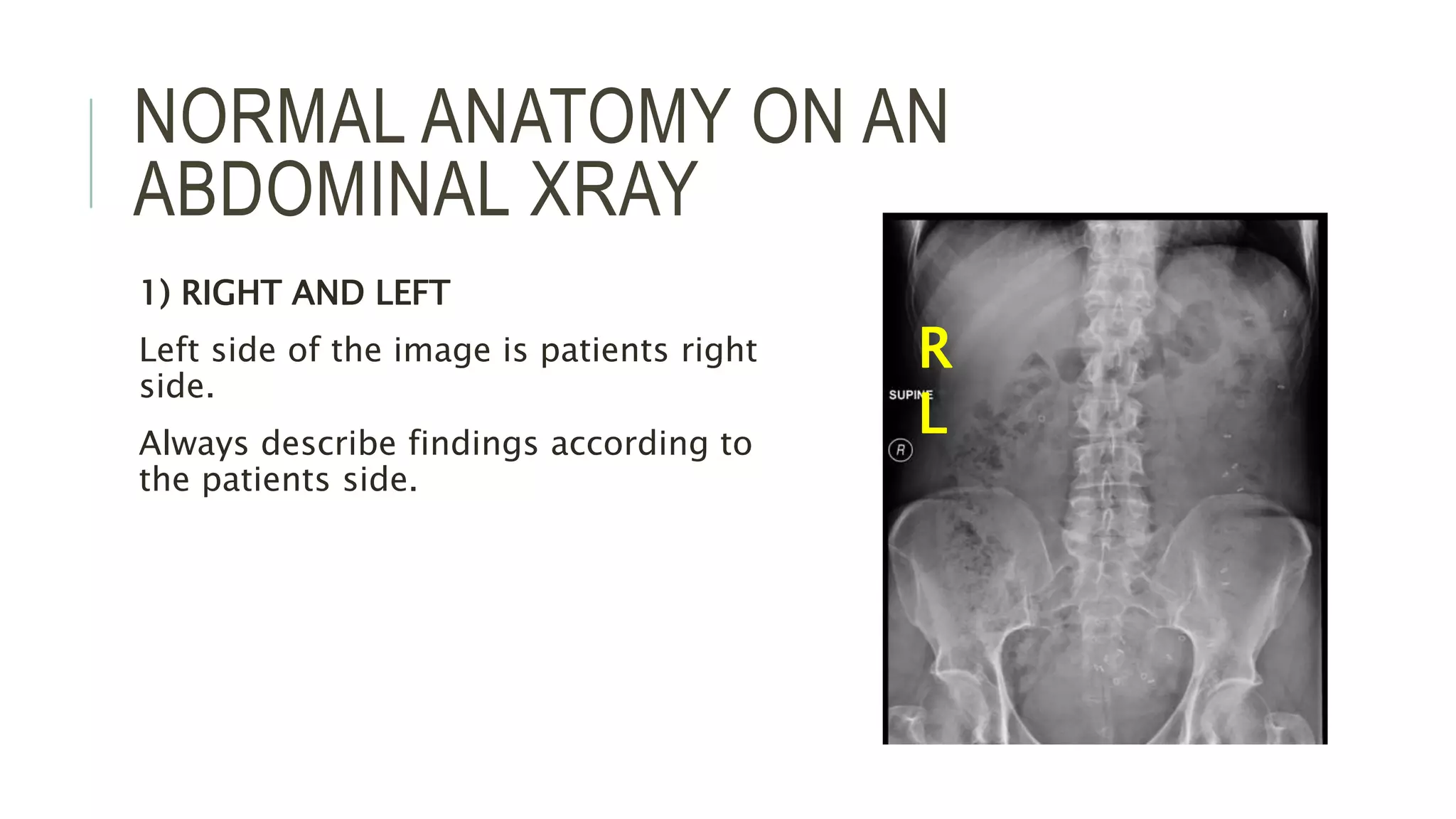 Abdominal xray - imaging and interpretation | PPTX