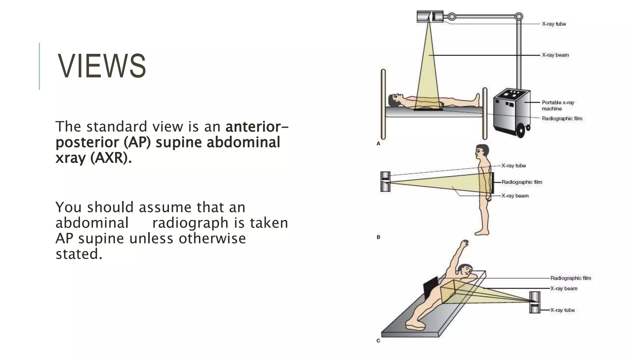 Abdominal xray - imaging and interpretation | PPTX