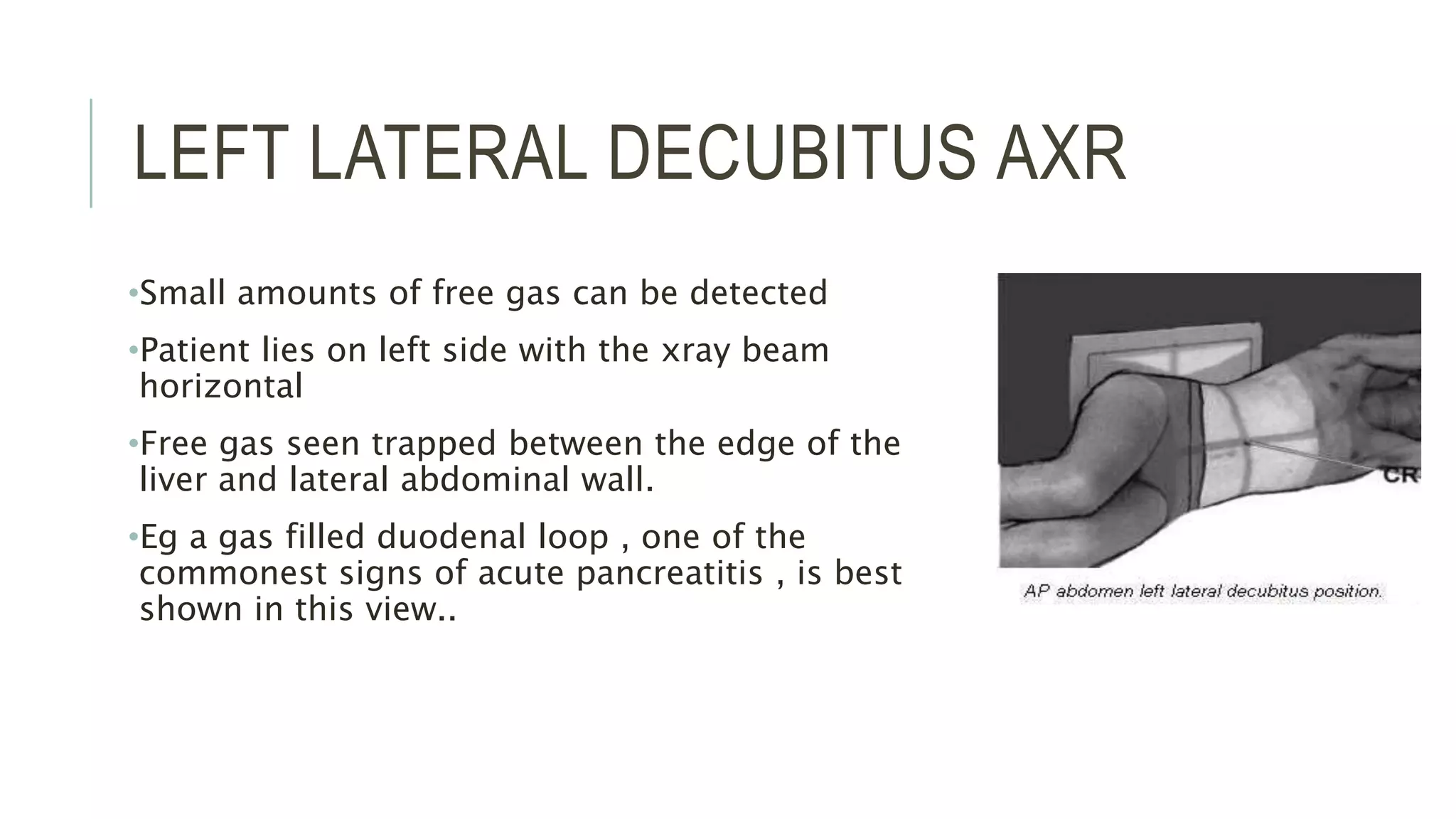 Abdominal xray - imaging and interpretation | PPTX