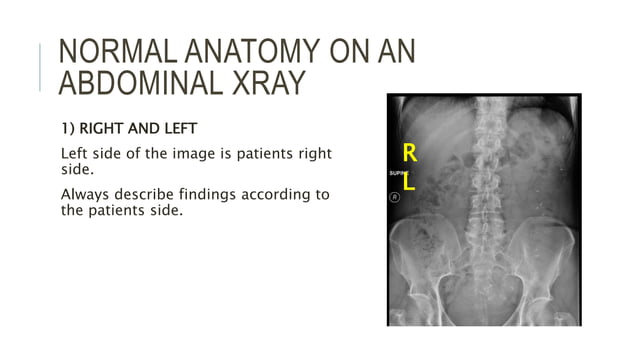 Abdominal xray - imaging and interpretation | PPTX