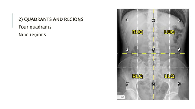 Abdominal xray - imaging and interpretation | PPTX