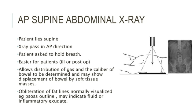 Abdominal xray - imaging and interpretation | PPTX