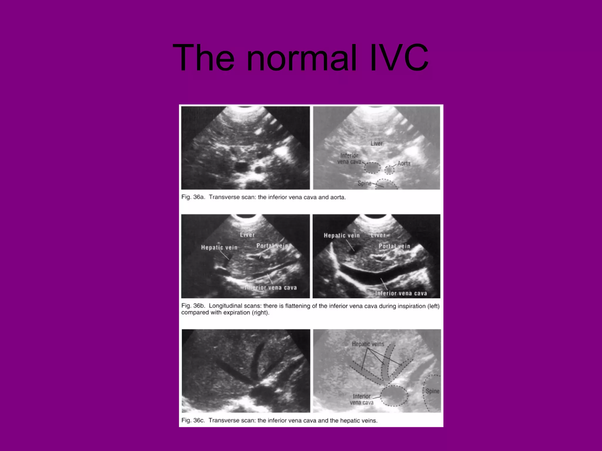 Abdominopelvic ultrasound | PPT