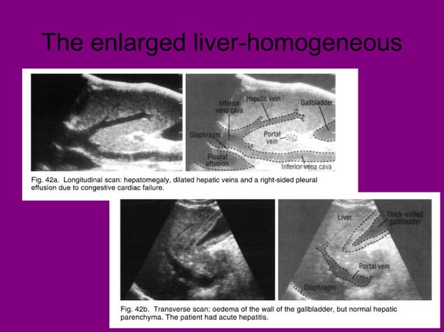 Abdominopelvic ultrasound | PPT