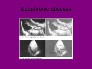 Abdominopelvic ultrasound | PPT