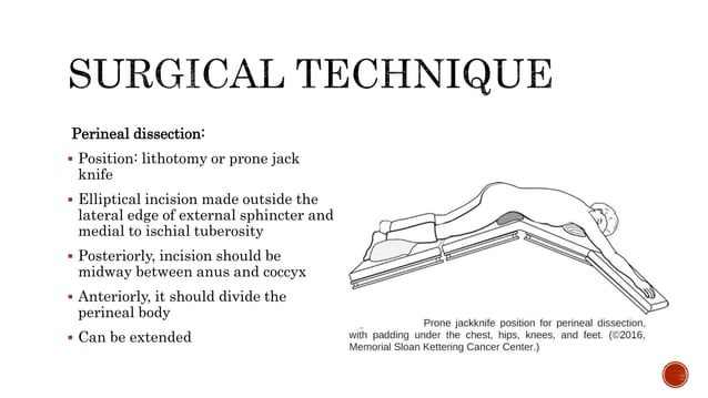 Abdominoperineal resection.pptx | Death, Injury, or Military Conflict ...