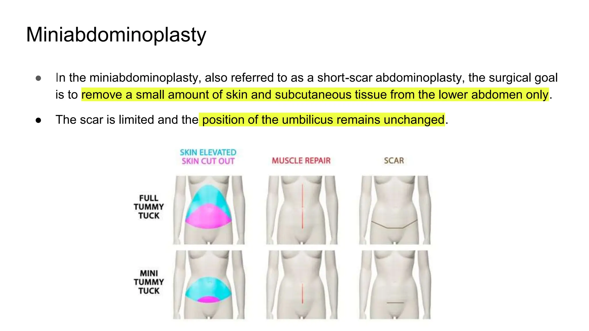 Anatomy of Abdominal wall and Abdominoplasty | PPTX