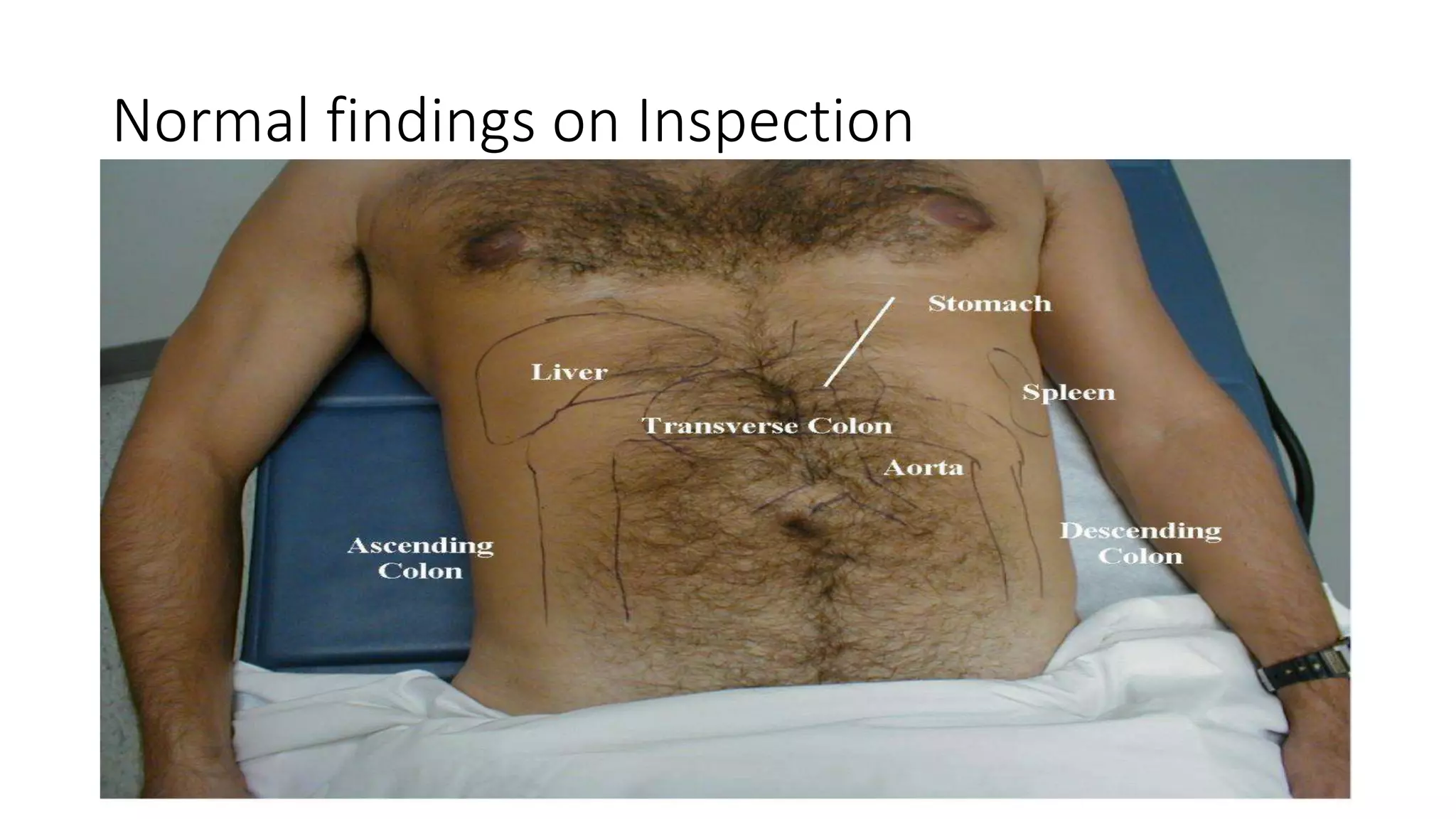 abdominal assessment | PPTX