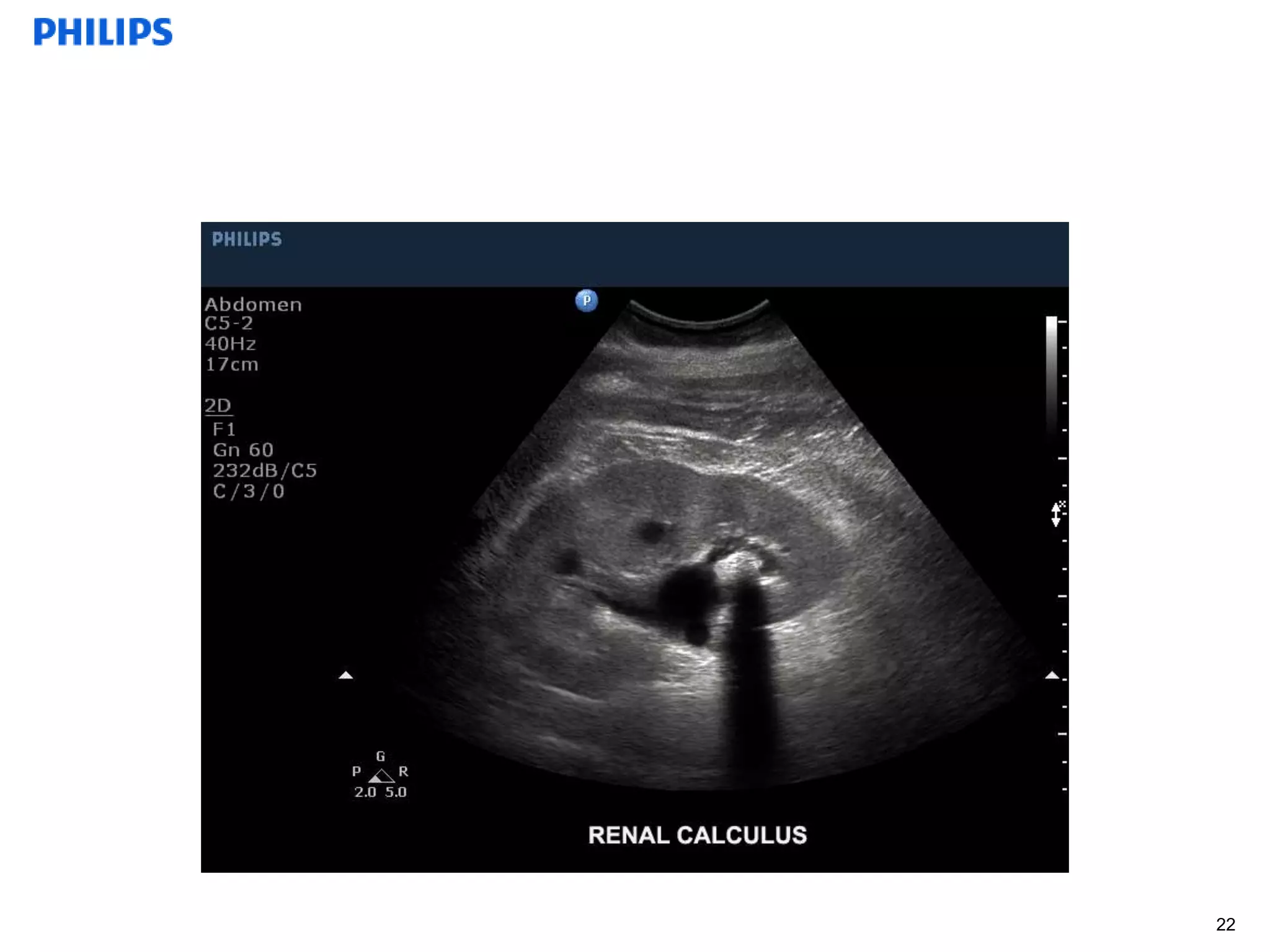 Abdo, smp, msk, vasc routine exams anatomy | PPTX