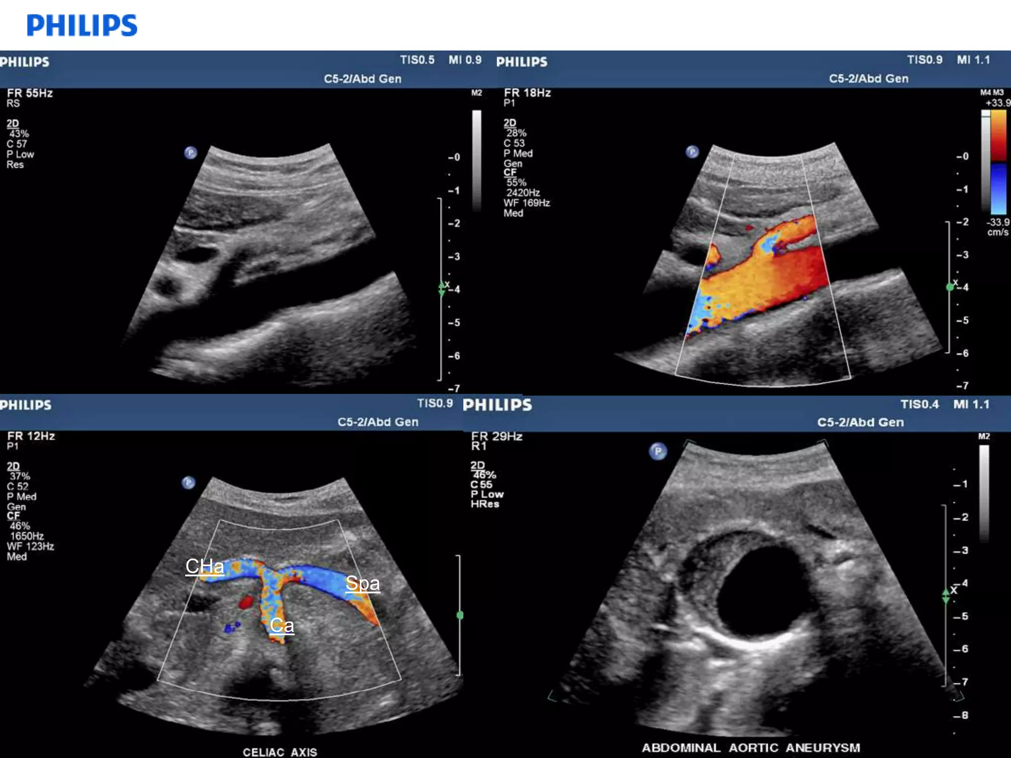 Abdo, smp, msk, vasc routine exams anatomy | PPTX