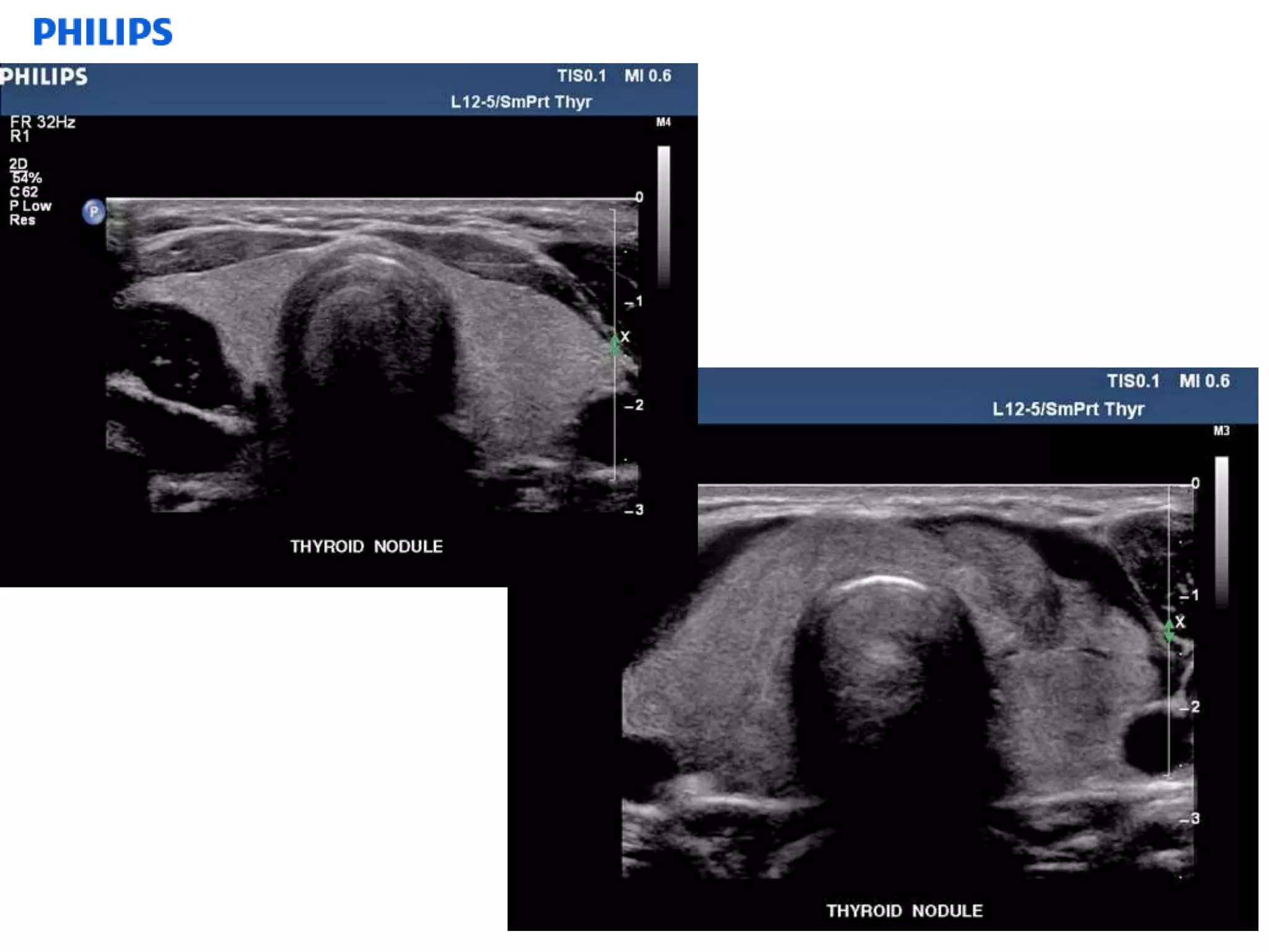 Abdo, smp, msk, vasc routine exams anatomy | PPTX
