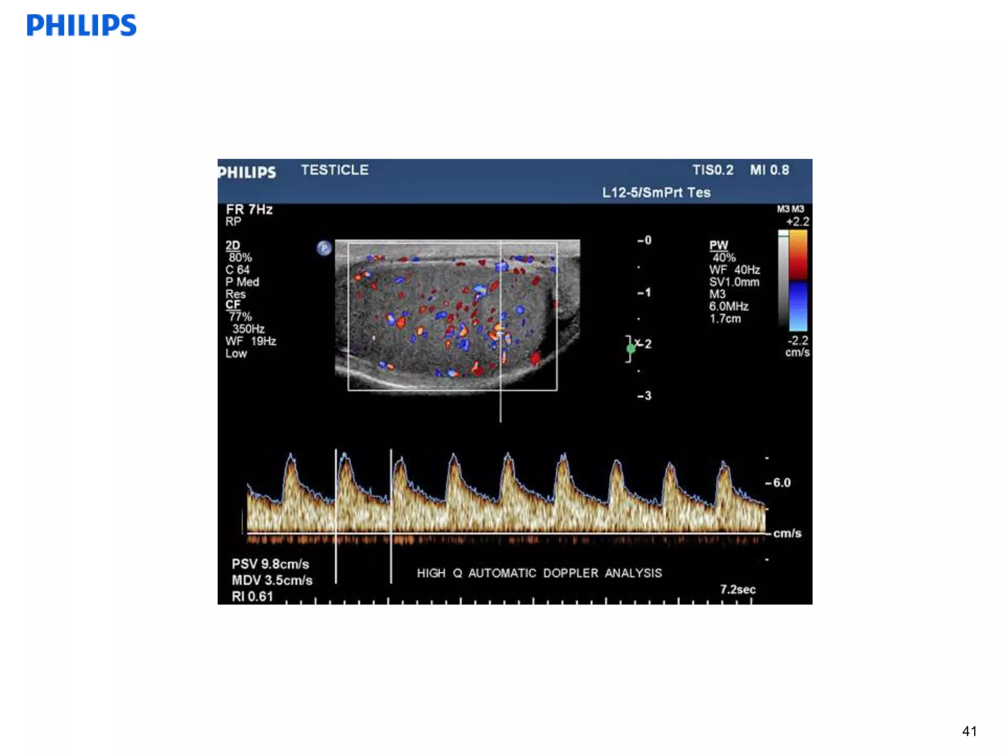 Abdo, smp, msk, vasc routine exams anatomy | PPTX