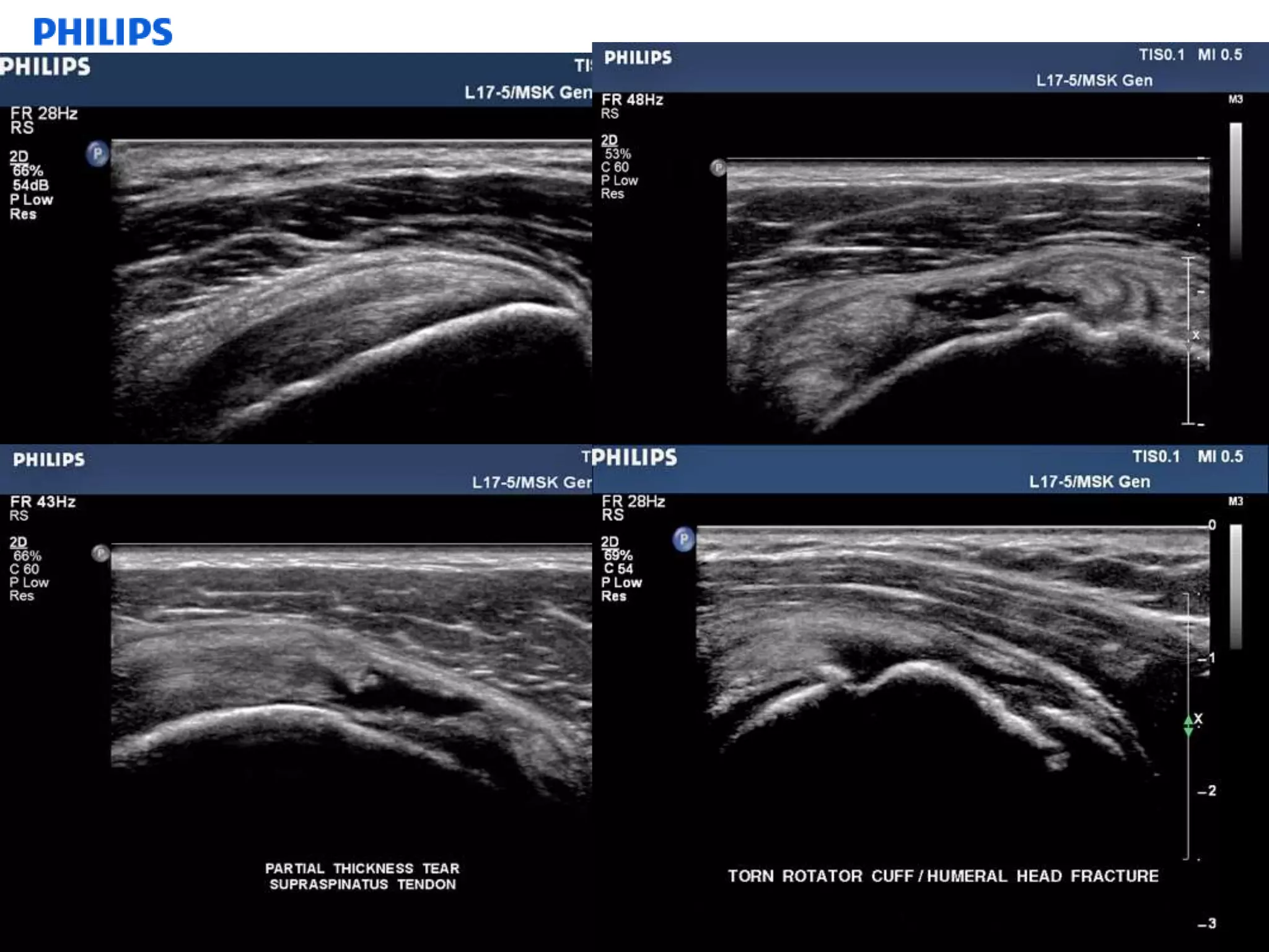 Abdo, smp, msk, vasc routine exams anatomy | PPTX