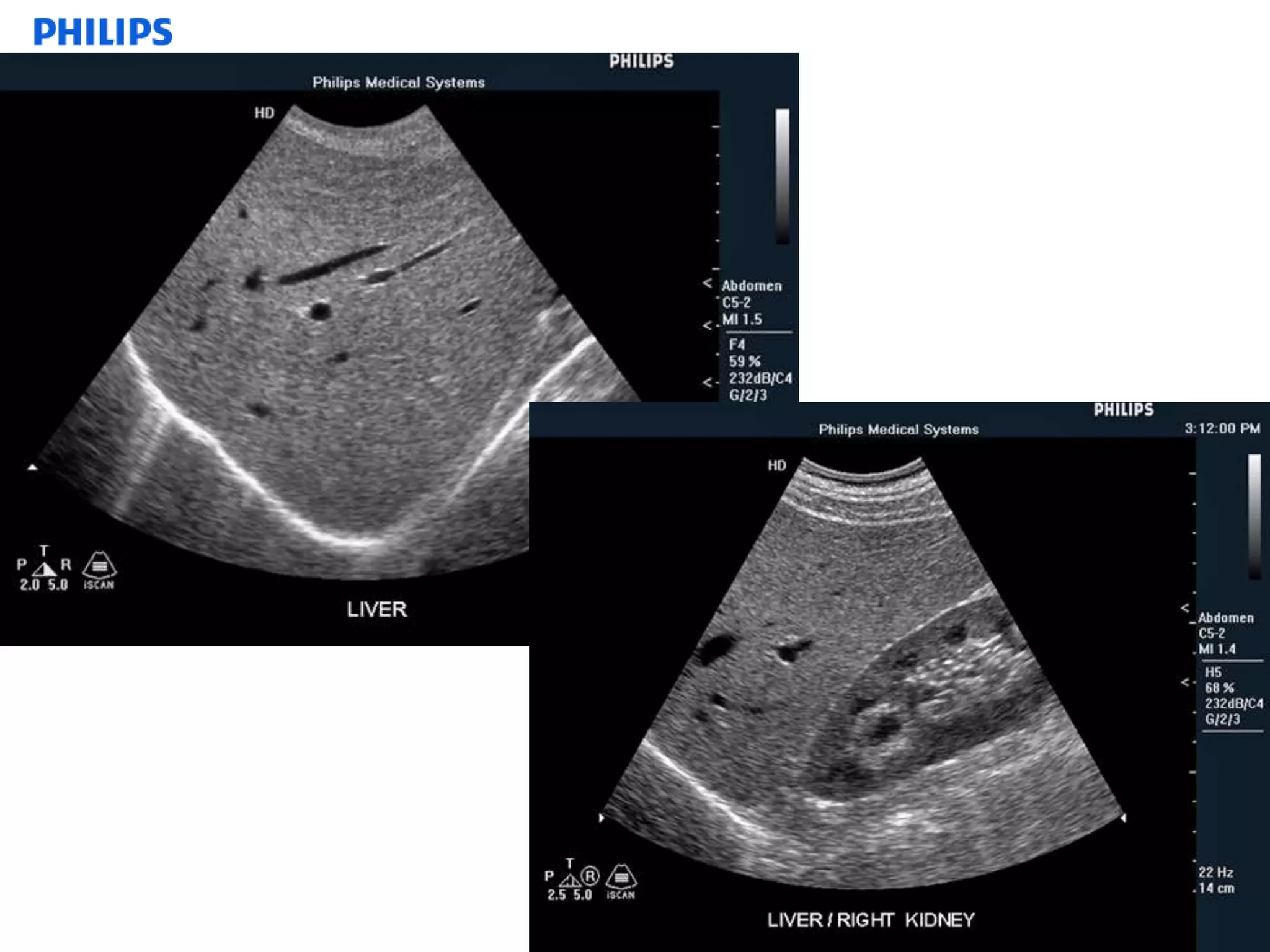 Abdo, smp, msk, vasc routine exams anatomy | PPTX