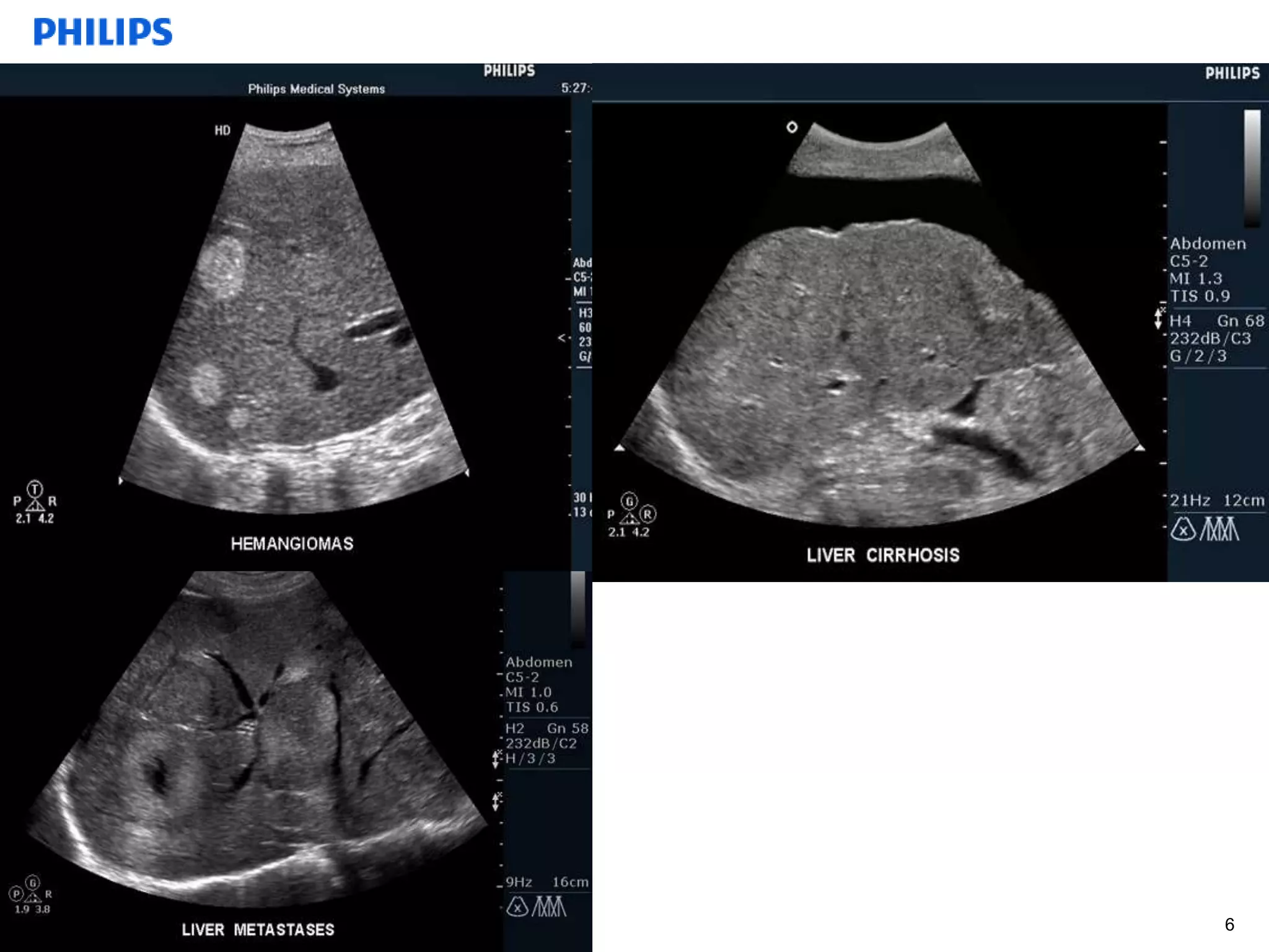 Abdo, smp, msk, vasc routine exams anatomy | PPTX