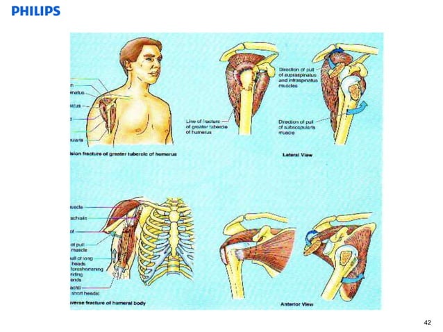 Abdo, smp, msk, vasc routine exams anatomy | PPTX | Thyroid Disorders ...