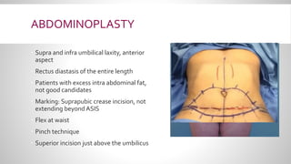 Abdominoplasty - Dr Mujtuba Pervez Khan | PPTX